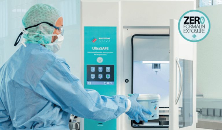 UltraSafe – Exposição zero de formol no manuseio de peças cirúrgicas ...